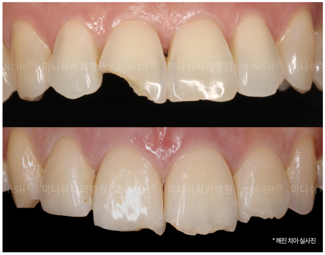 4 Common dental problems and Tips to prevent them